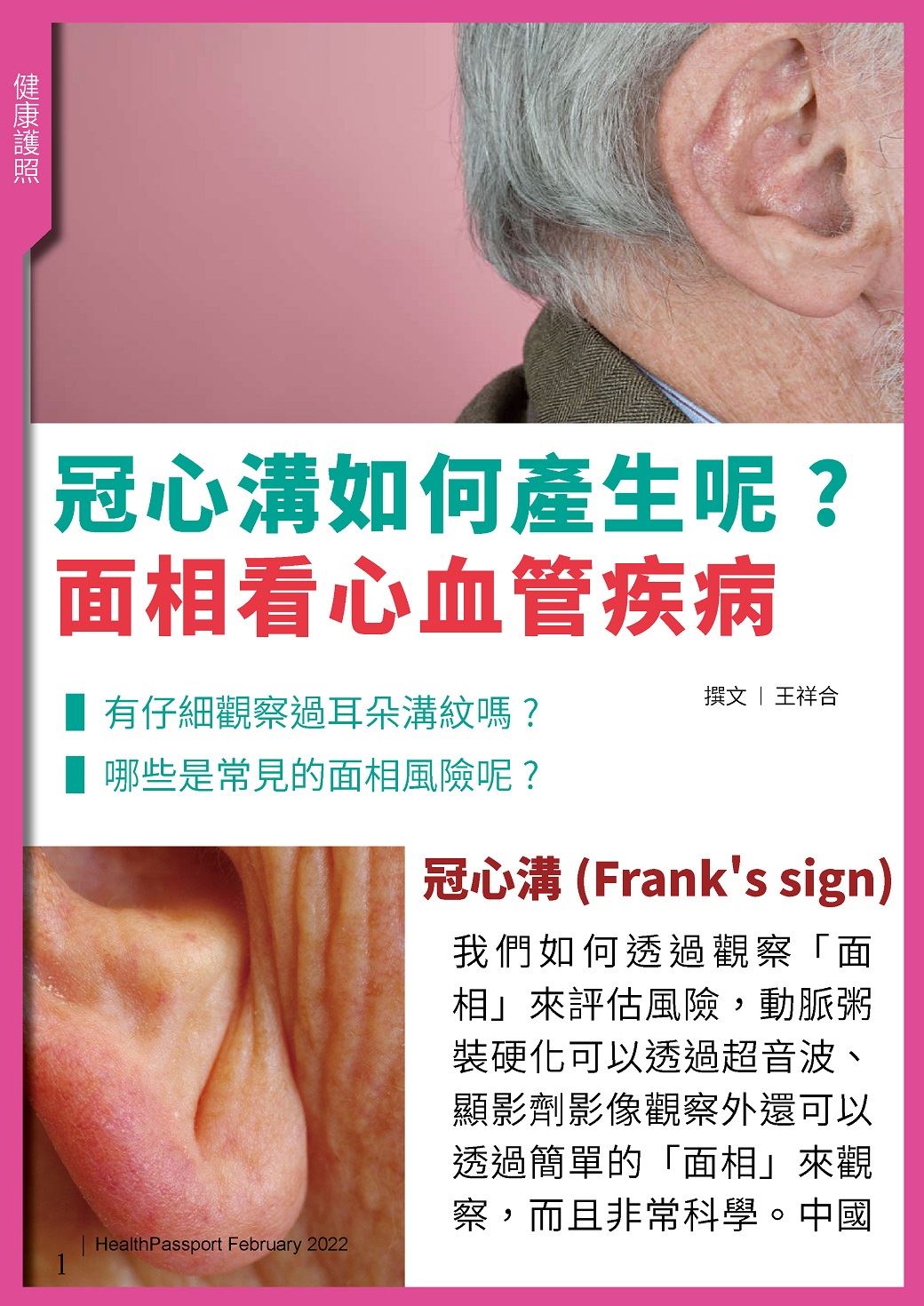 冠心溝(Frank's sign)如何產生呢? 心血管疾病的判斷方法